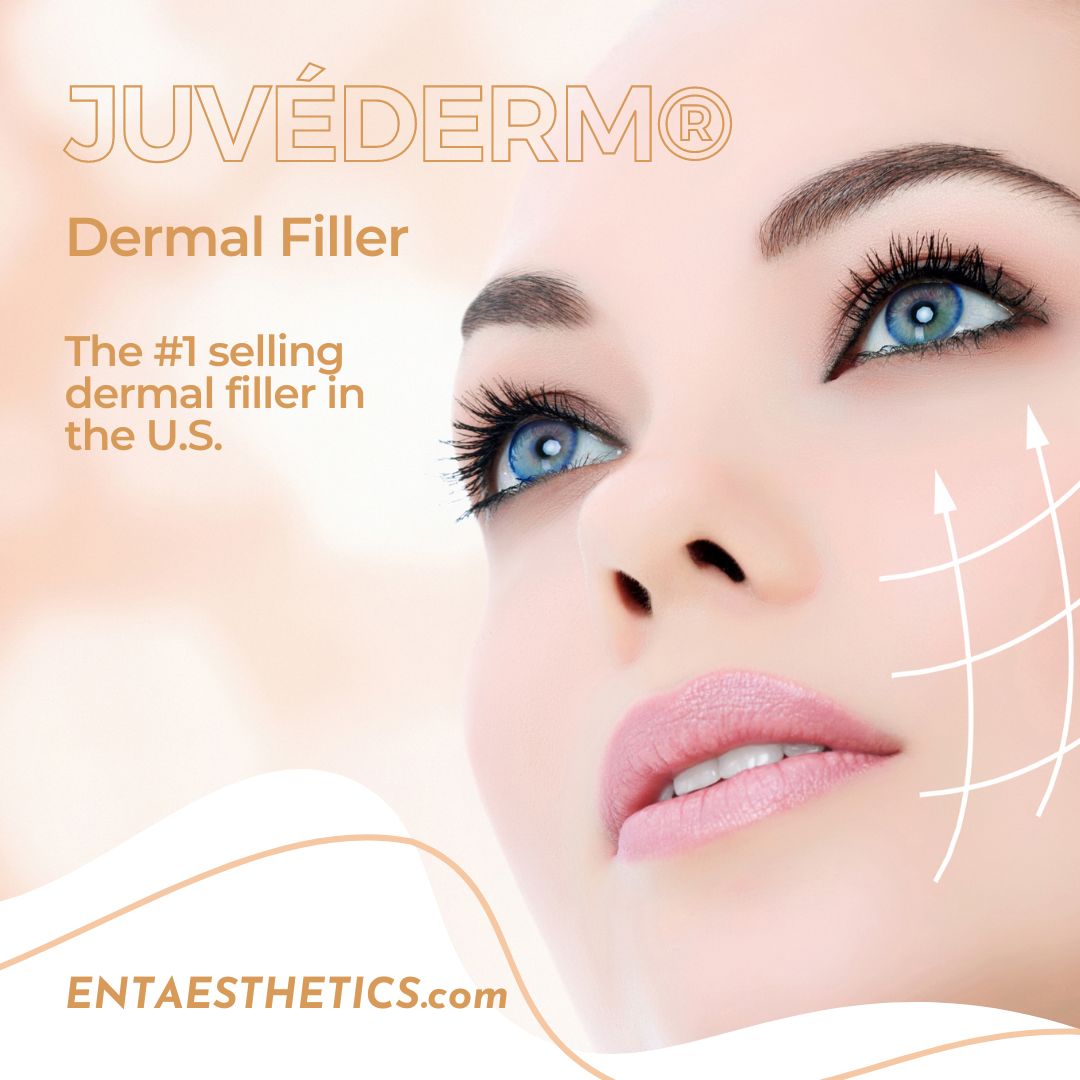 Juvéderm - ENT Aesthetics