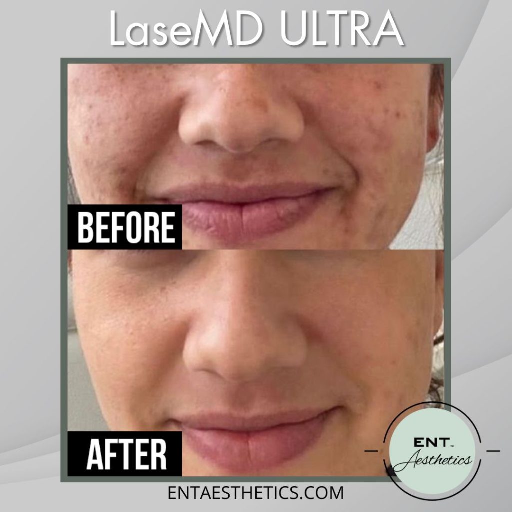 Total Skin Treatment - ENT Aesthetics